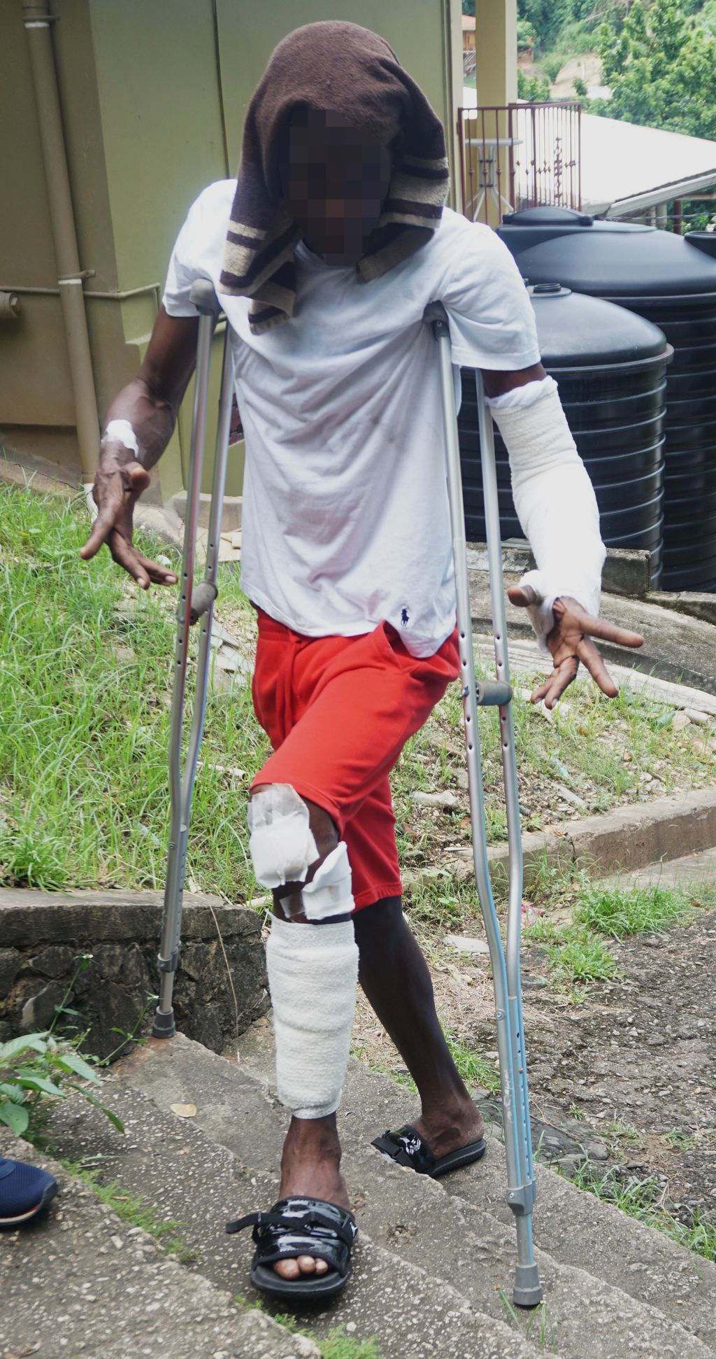 Belmont shooting survivor grateful for life; 1 suspect dead - Trinidad ...